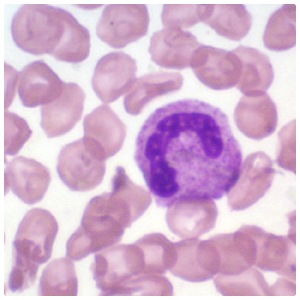 Conheça os leucócitos | Biomedicina Padrão